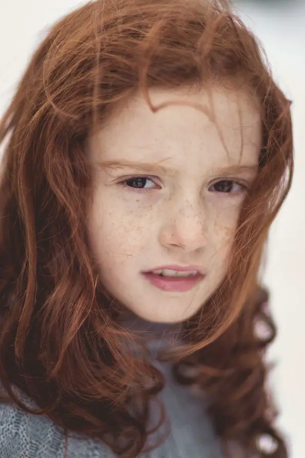 Are Babies Born with Freckles? - Urban Mamas